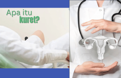 Apa Itu Kuret? Pengertian dan Fakta Tentang Kuretase